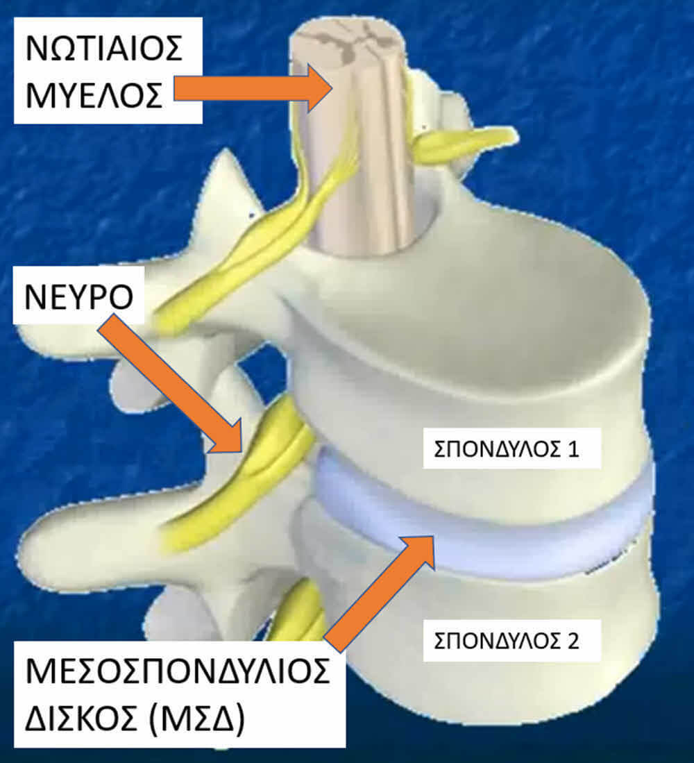 Κήλη στον Αυχένα | Dr. Χλωρός Γιώργος